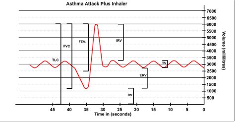 Solved Lab Report Experiment Data Patient Type Heavy