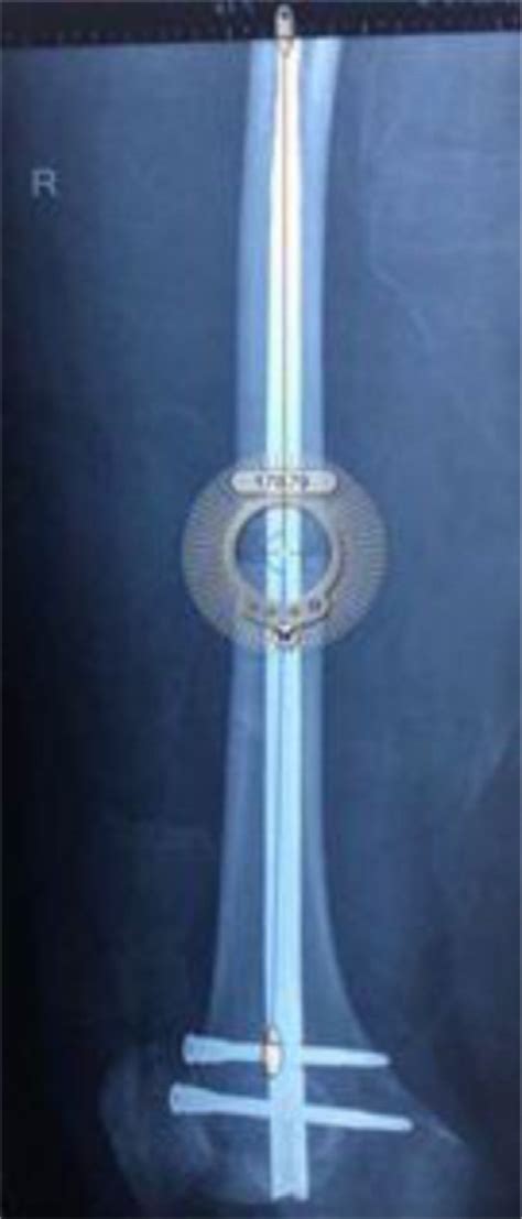 Screen Protractor Tool Download Scientific Diagram