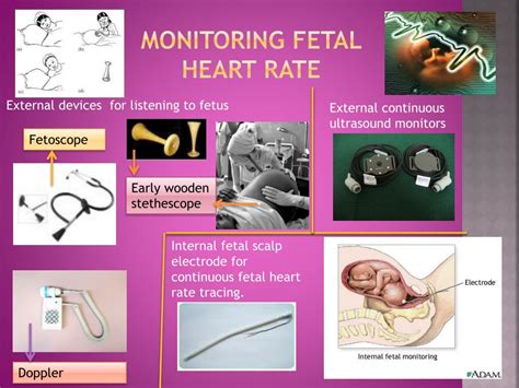 Ppt Electronic Fetal Monitoring Powerpoint Presentation Free
