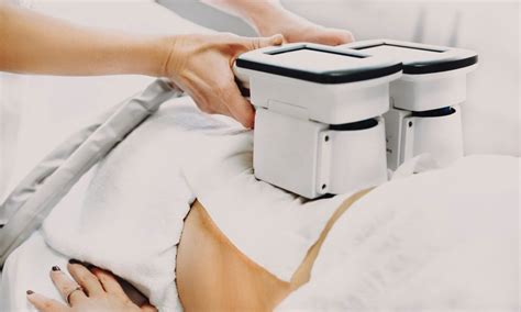 What Are The Key Steps Involved In A Coolsculpting Treatment
