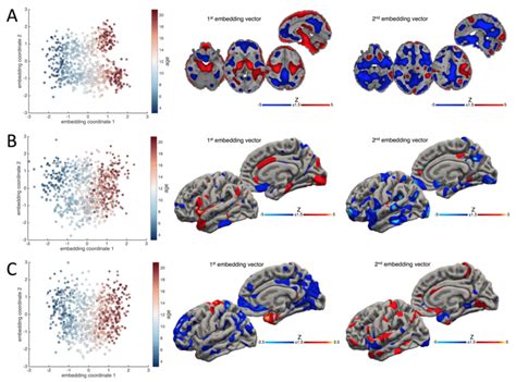manifold structure for tissue volume cortical area and cortical