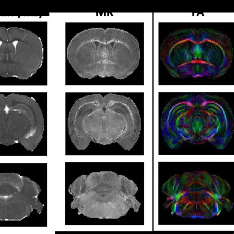 Ex Vivo Imaging Of The Human Brain Facilitates High Resolution And High Download Scientific