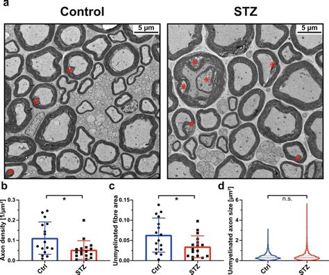 Ultrastructural Analysis Of The Sciatic Nerves From Stz Diabetic Mice