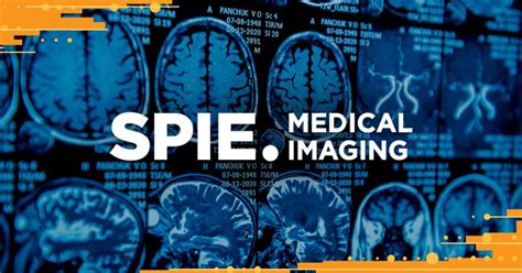 Modular Breast And Tumor Perfusion Phantoms For Validation Of 4d Dynamic Advanced X Ray
