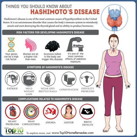 Sindrome De Hashimoto
