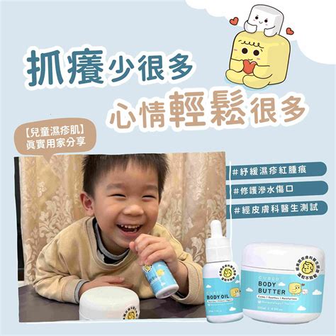 【cubed產品評價】兒童濕疹肌真實用家分享：抓癢少很多，爸媽心情輕鬆很多 Cubed 為問題肌而生