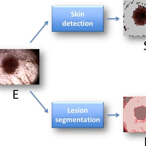 Skin Lesion Segmentation A Dermoscopic Image In Input B Binary Mask Download Scientific