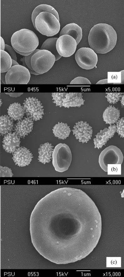Sem Photographs Of Human Erythrocytes With Various Shapes Of A