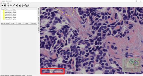 how can i get the the value corresponding to the max magnification · issue 199