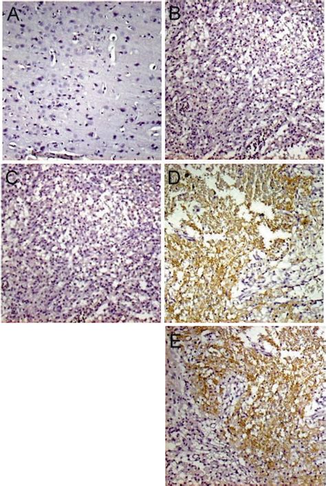 Simvastatin Attenuates The Cerebral Vascular Endothelial Inflammatory
