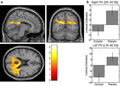 Neural Activity In The Temporoparietal Junction A Neural Activity Download Scientific