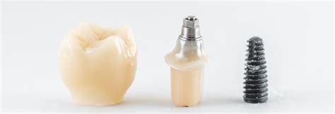 Biomaterials Biomedical Engineering Schulich Dentistry Western University