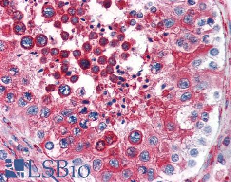 Ihc Plus™ Rtn4 Nogo Polyclonal Antibody Rabbit Anti Human Lsbio