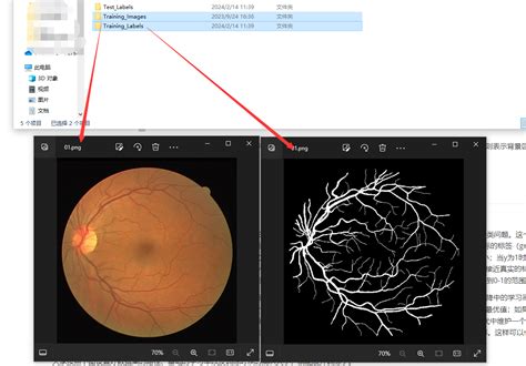 【大作业 14】手把手教你用unet做眼底血管图像分割unet眼底血管图像分割 Csdn博客