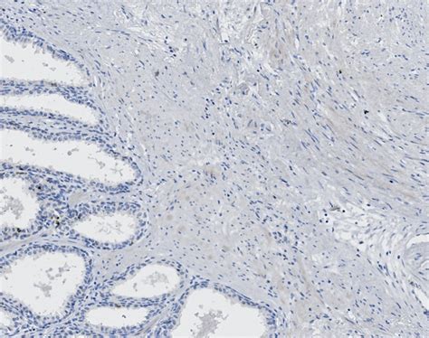 Tissue Tek Genie Rapid True Random Access Ihc Staining
