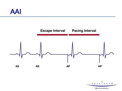 Ppt Nbg Pacemaker Code Powerpoint Presentation Id 6724840