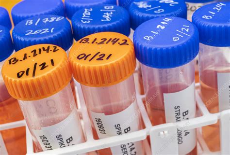 Sars Cov 2 Variant Research Conceptual Image Stock Image F0363536