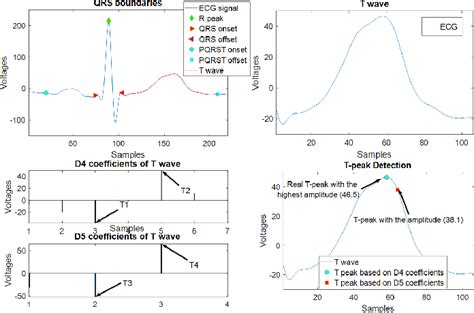 Figure 9 From An Automatic R And T Peak Detection Method Based On The