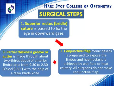 Intracapsular Cataract Extraction Pptx