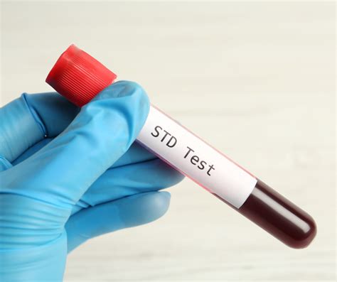 Can You Get Std Testing At Urgent Care Zip Clinic Urgent Care®