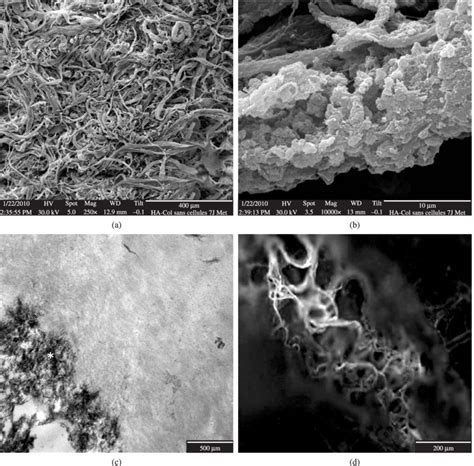 Sem Micrographs Of The Ha Col Scaffold Surface A Detail Of Collagen Download Scientific