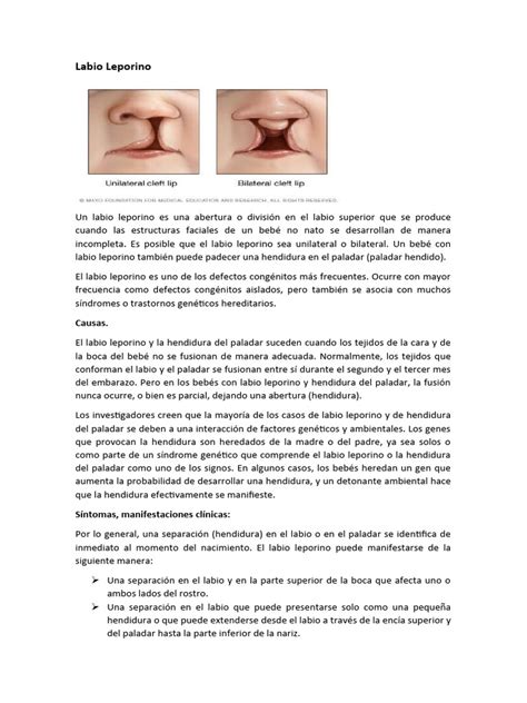 Labio Leporino Causas Y Síntomas Pdf Especialidades Medicas