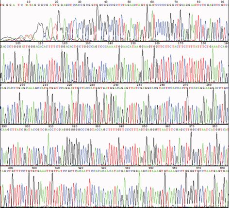 Presto™ Mini Plasmid Extraction Kit Dna Cloning Service
