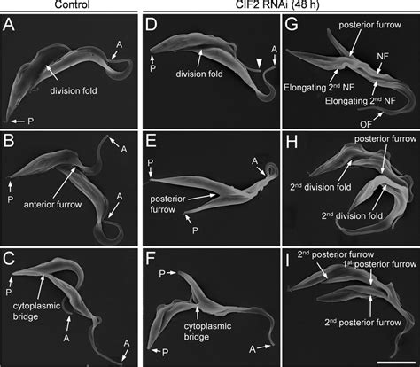 Scanning Electron Microscopic Analysis Of Cleavage Furrow Ingression In