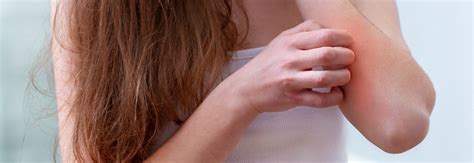 Atopic Dermatitis Vs Eczema Whats The Difference