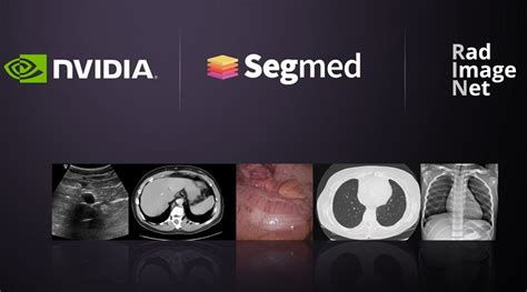 Segmed Nvidia And Radimagenet Kickstart Generative Ai Initiative For Synthetic Medical Imaging