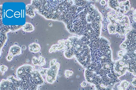 Ls513 人结直肠癌细胞 原代细胞 Str细胞 细胞培养基 镜像绮点生物