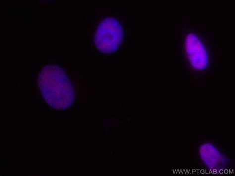 Rbm15 Monoclonal Antibody 4a1a4 Coralite594 Proteintech 100 μl