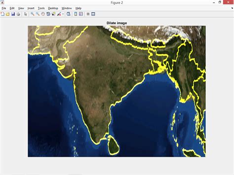 Basic Morphological Operation Using Matlab Digital Image Processing