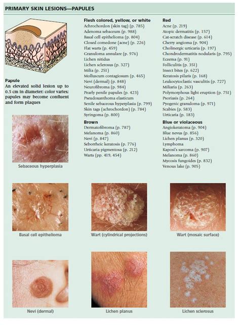 Primary Skin Lesions