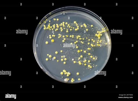 Micrococcus Luteus Characteristics Morphology Diseases 50 Off