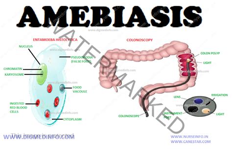 Amebiasis General Characteristics Pathology Clinical Manifestations