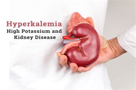 Hyperkalemia Causes Symptoms And Treatment Options