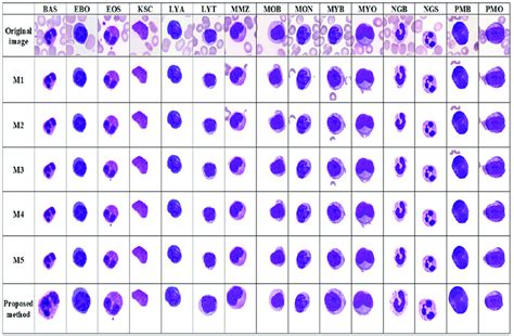 results of 15 different types of wbc segmentation using the proposed download scientific