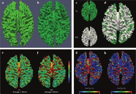 Comparison Of Cortical Surface Reconstruction Approaches A A Download Scientific Diagram