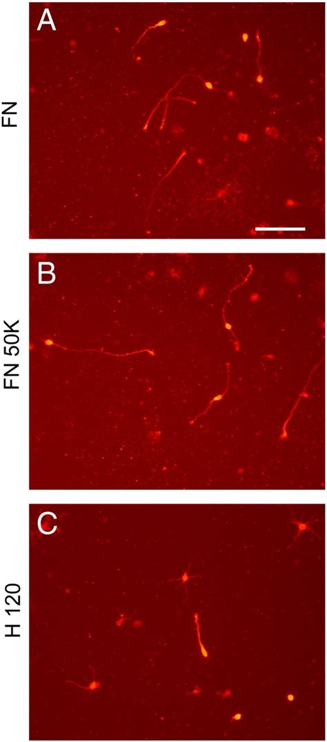 Fibronectin Supports Neurite Outgrowth And Axonal Regeneration Of Adult Brain Neurons In Vitro Pmc