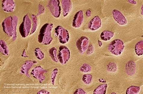 Progress In 3d Bioprinting Technology For Osteochondral Regeneration