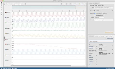Labchart Lightning Eeg Ekg And Ecg Data Acquisition Daq Software