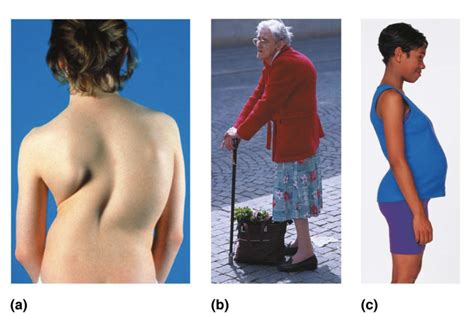 Chapter The Skeleton Axial Lab Exam Pt Diagram Quizlet