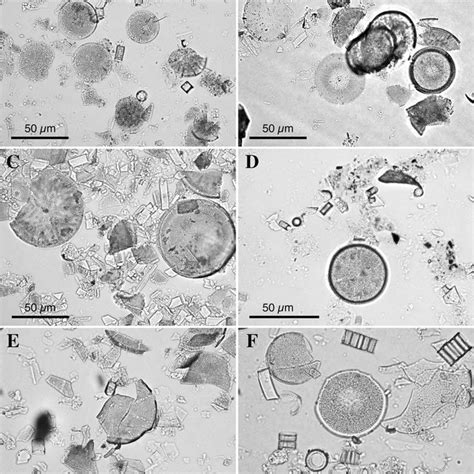 Sem Photographs Of Actinocyclus Species From Early To Middle Miocene Download Scientific