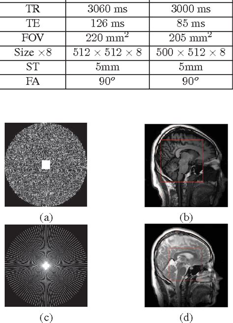 Figure 1 From Partially Parallel Mr Image Reconstruction Using