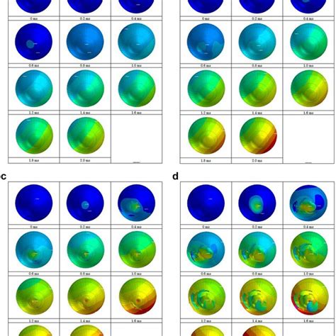 Sequential Deformity Of Long Axial Length Myopic Model Eye Upon