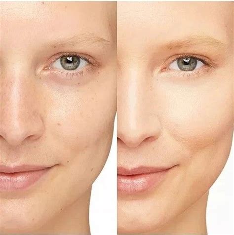 Before And After Applying Concealer