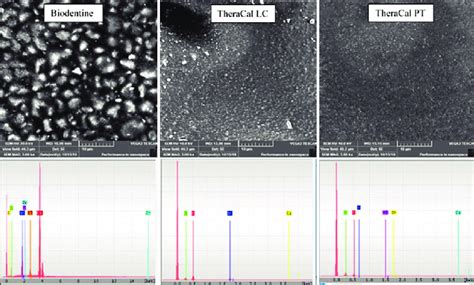 Environmental Scanning Electron Microscope Images With Corresponding