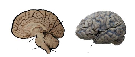 Subarachnoid Cisterns Diagram Quizlet Subarachnoid Cisterns Diagram Quizlet