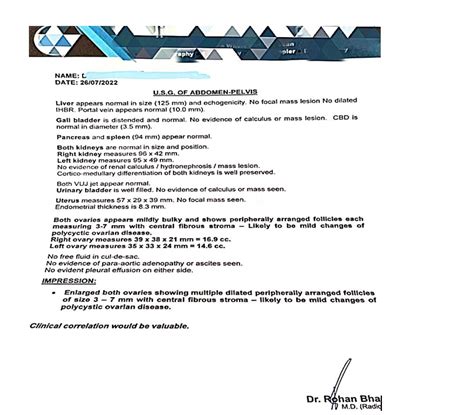 A CASE STUDYOF PCOS TREATED WITH HOLISTIC APPROACH